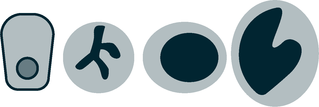 C'est quoi une mammite ? - Sante Troupeau