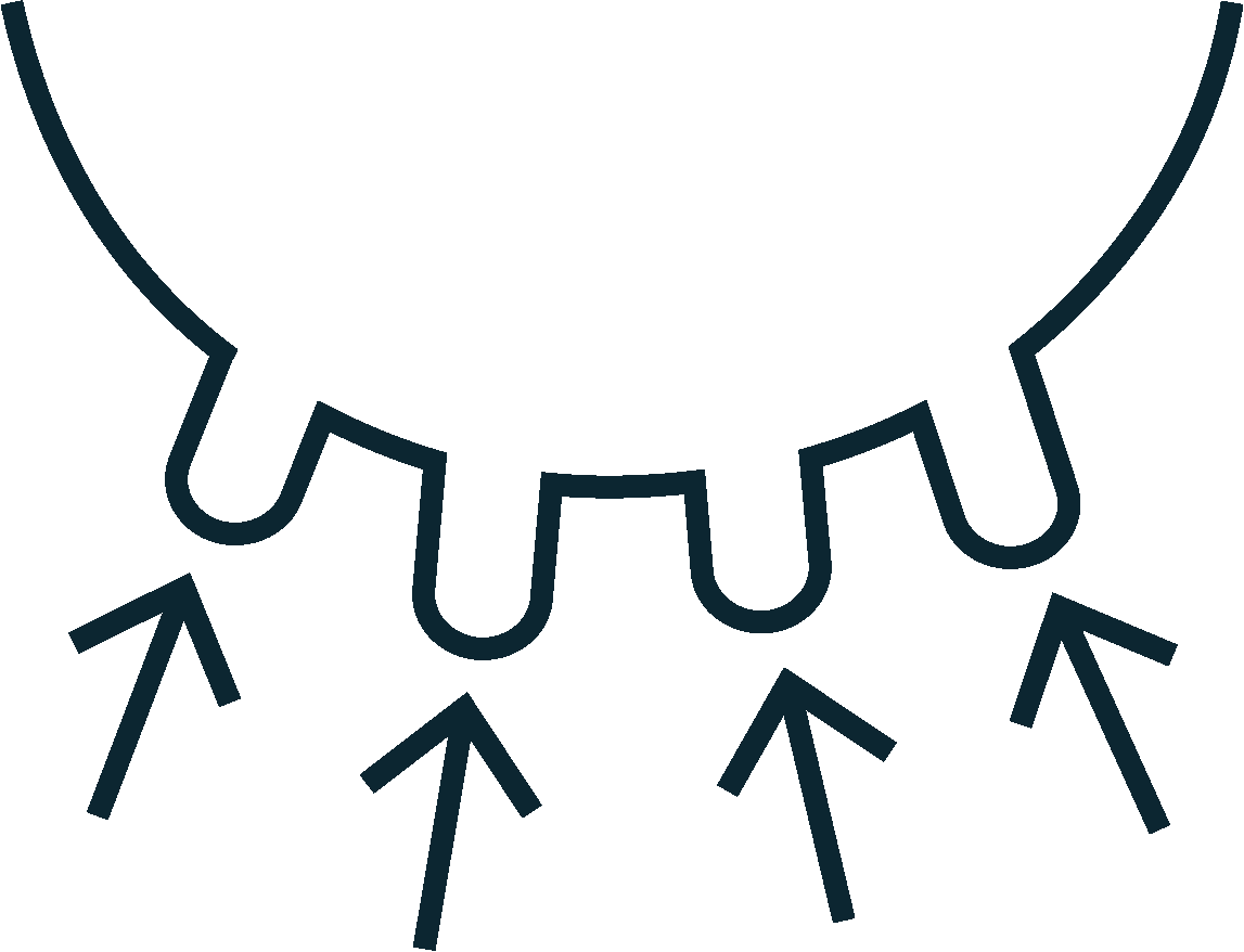 C'est quoi une mammite ? - Sante Troupeau